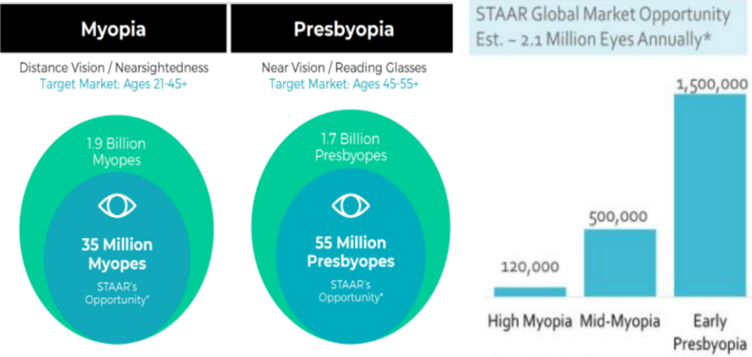 融汇研究 | 眼科ICL：STAAR在国内30万例手术/年，国产产品如何打破格局？医药新闻-ByDrug-一站式医药资源共享中心-医药魔方