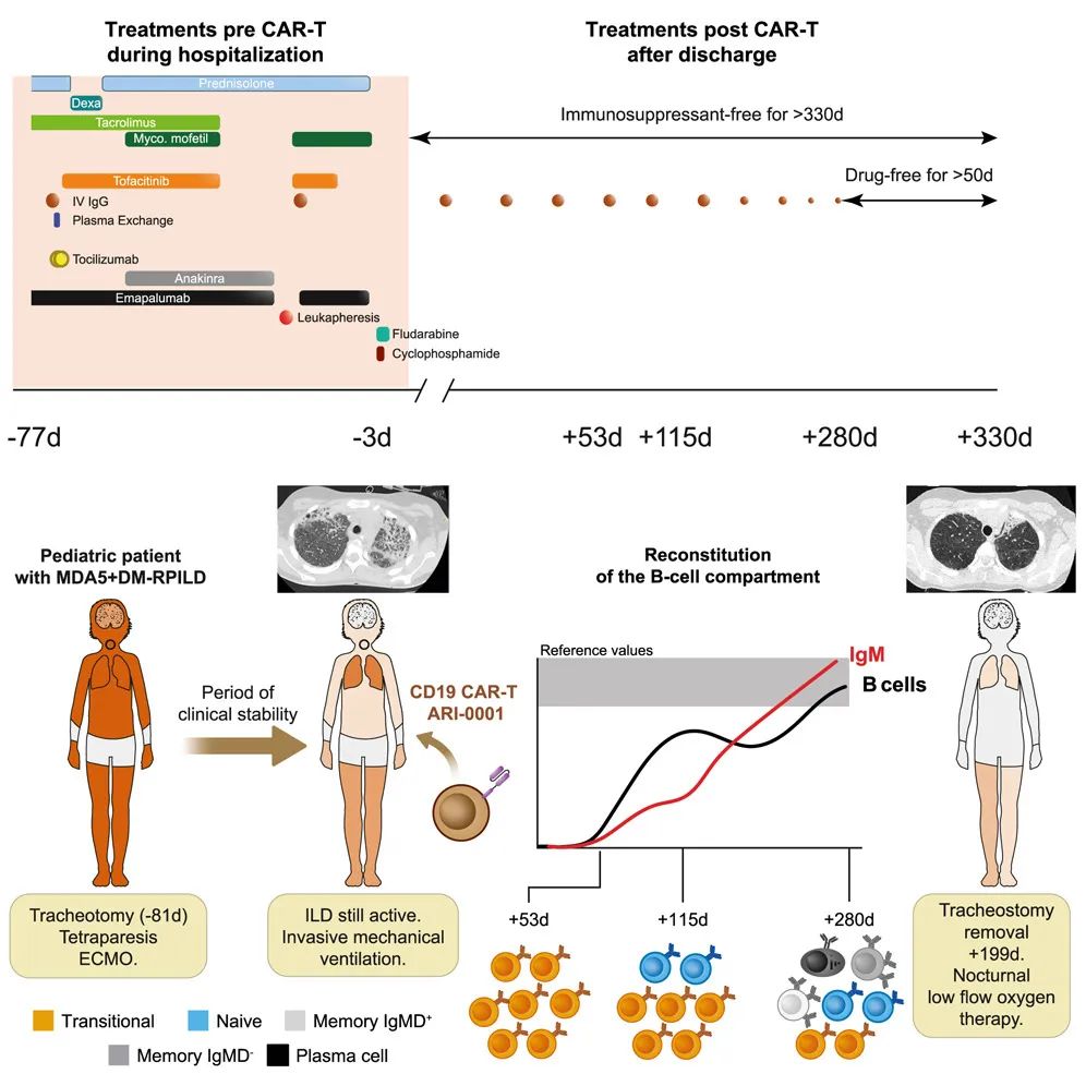 Cell子刊：CAR-T细胞疗法又攻克一种自身免疫疾病医药新闻-ByDrug-一站式医药资源共享中心-医药魔方