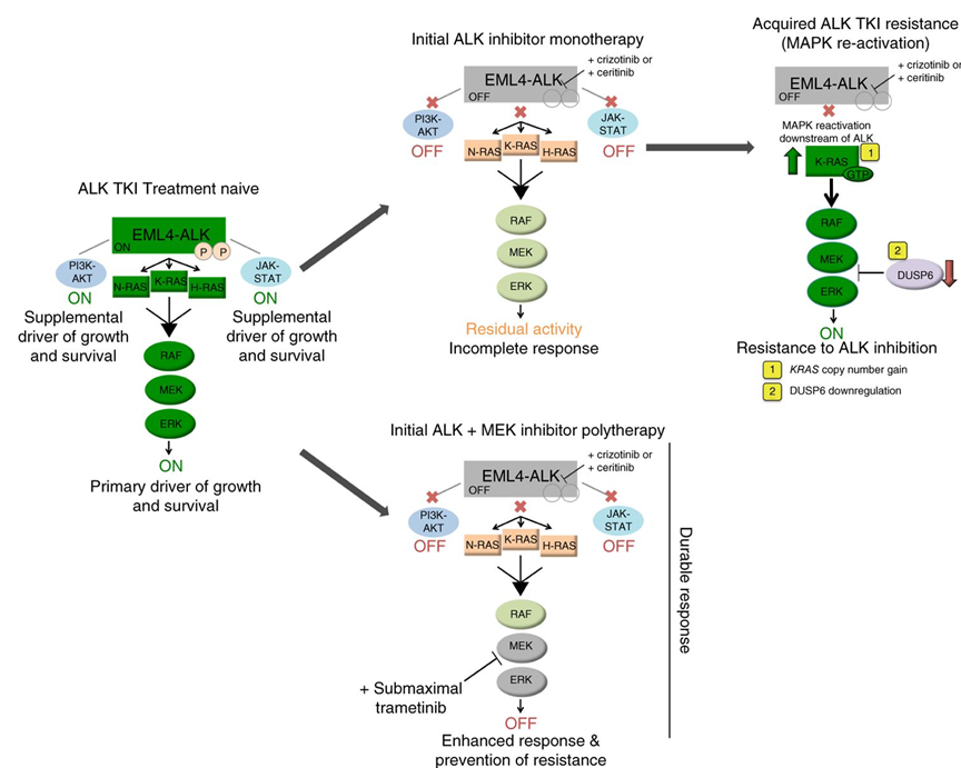 【医诺学院】宋勇教授点评：独自迭代升级，还是联合应用发展？——ALK TKI应用新场景医药新闻-ByDrug-一站式医药资源共享中心-医药魔方