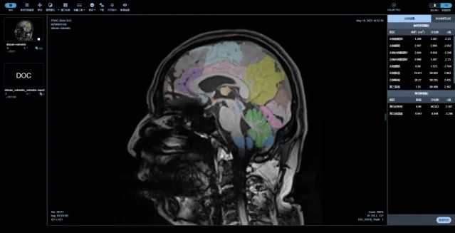 医未AI卒中获批NMPA三类证｜道彤Family医药新闻-ByDrug-一站式医药资源共享中心-医药魔方