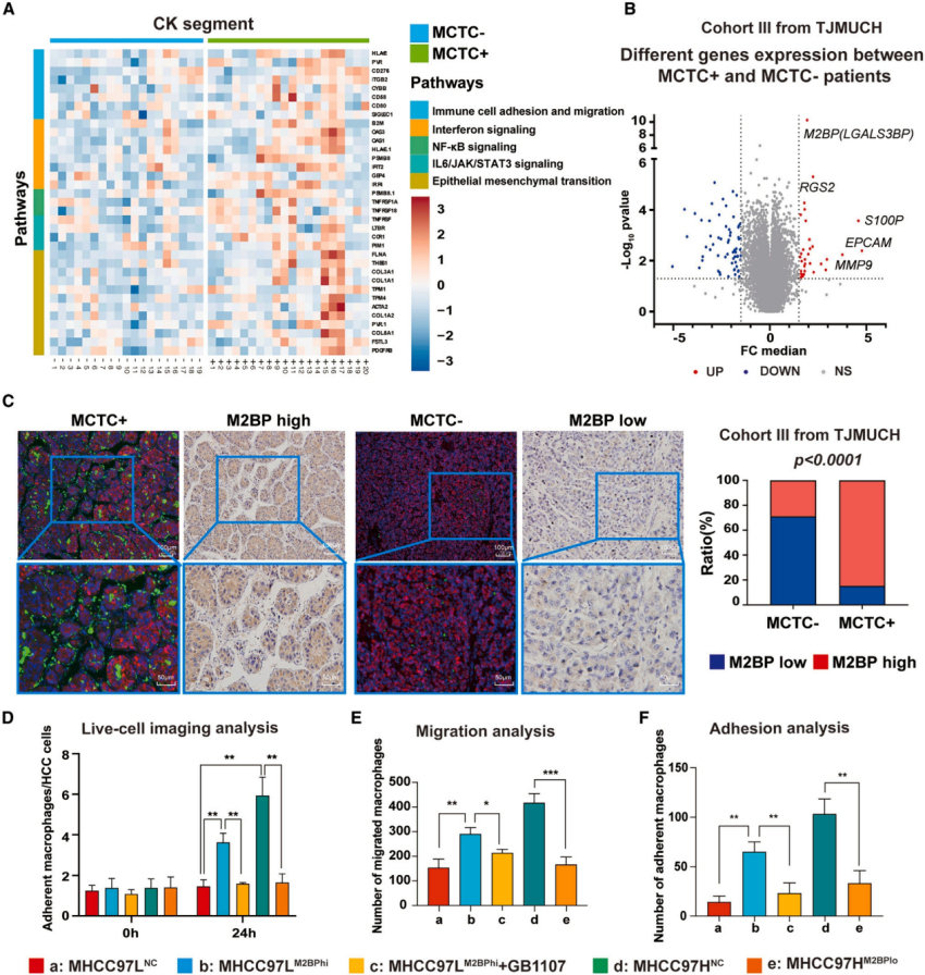 Cell 子刊丨HCC患者预后不良及肿瘤侵袭性的新发现医药新闻-ByDrug-一站式医药资源共享中心-医药魔方