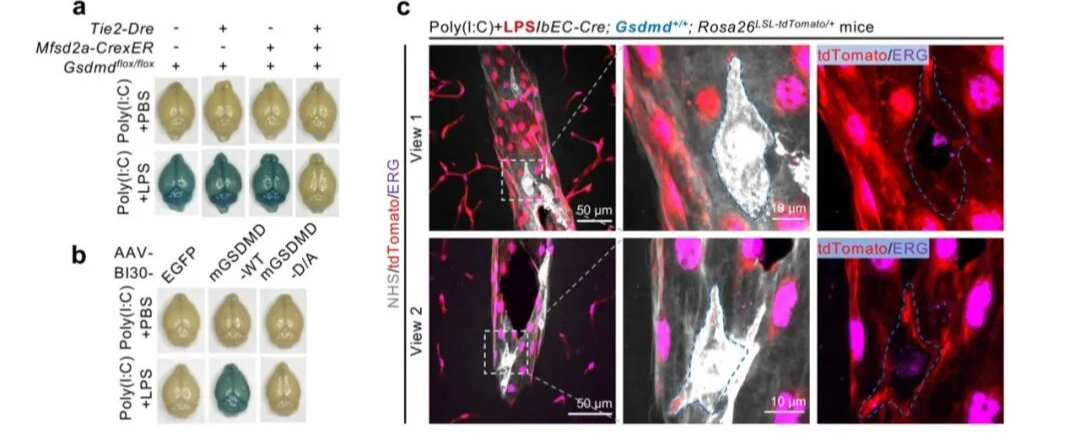 Nature！罗敏敏团队与邵峰团队合作揭示GSDMD的激活是炎症性血脑屏障破坏的关键机制医药新闻-ByDrug-一站式医药资源共享中心-医药魔方