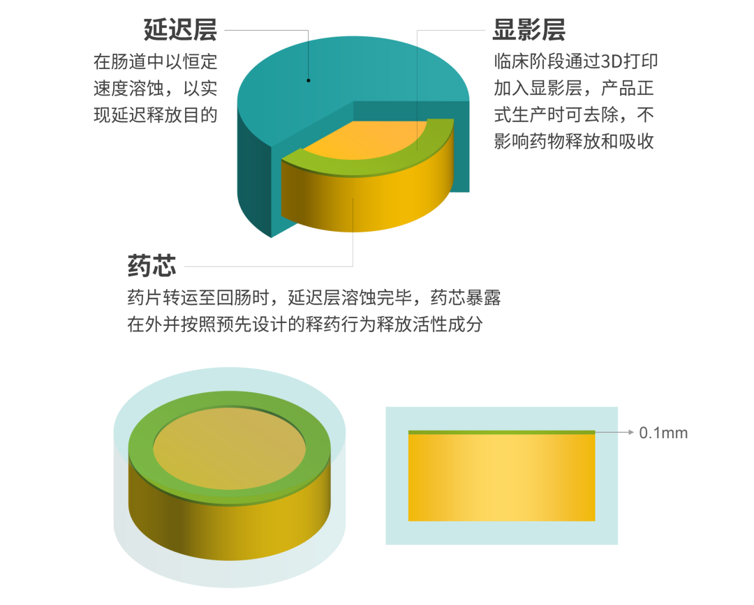 三迭纪IgA肾病药物产品D23取得积极临床结果，验证精准肠道靶向递送能力医药新闻-ByDrug-一站式医药资源共享中心-医药魔方
