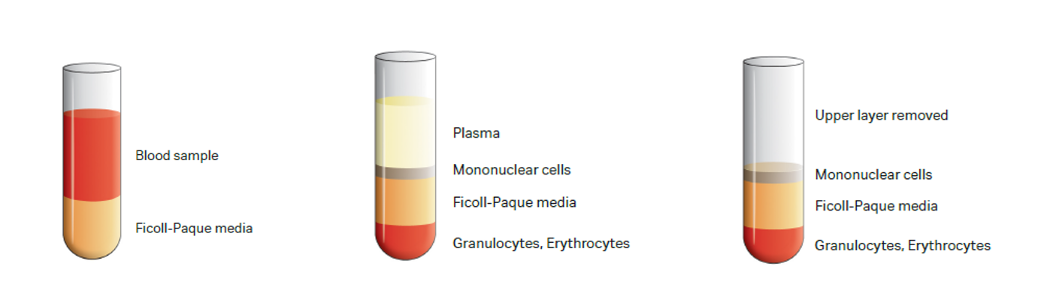 Ficoll-Paque应用解析：PBMCs分离中病人样本的特殊性医药新闻-ByDrug-一站式医药资源共享中心-医药魔方