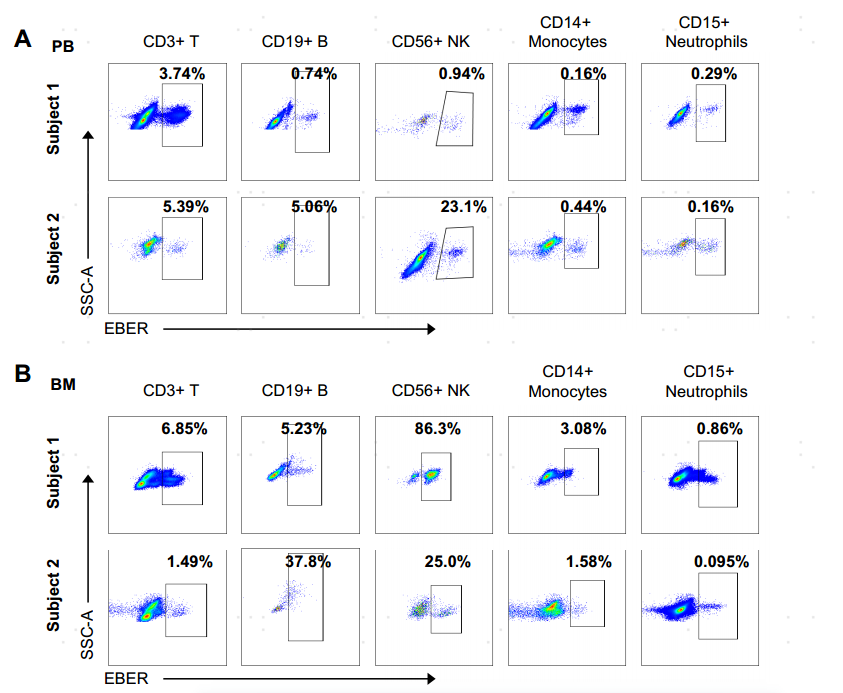 项目文章 | 单细胞靶向测序绘制慢性活动性EB病毒感染分子图谱医药新闻-ByDrug-一站式医药资源共享中心-医药魔方