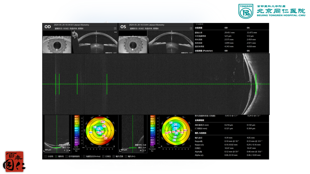 再出颠覆性新品！Intalight赛炜第2代可视化扫频生物测量技术亚太APACRS震撼发布医药新闻-ByDrug-一站式医药资源共享中心-医药魔方