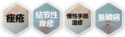 多靶点FIC，湿疹特效药GP2102完成临床前研究，提交IND医药新闻-ByDrug-一站式医药资源共享中心-医药魔方