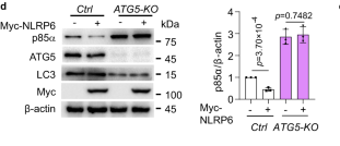 NLRP6通过促进p85α的自噬降解增强PI3K/AKT信号通路从而驱动肿瘤发生医药新闻-ByDrug-一站式医药资源共享中心-医药魔方