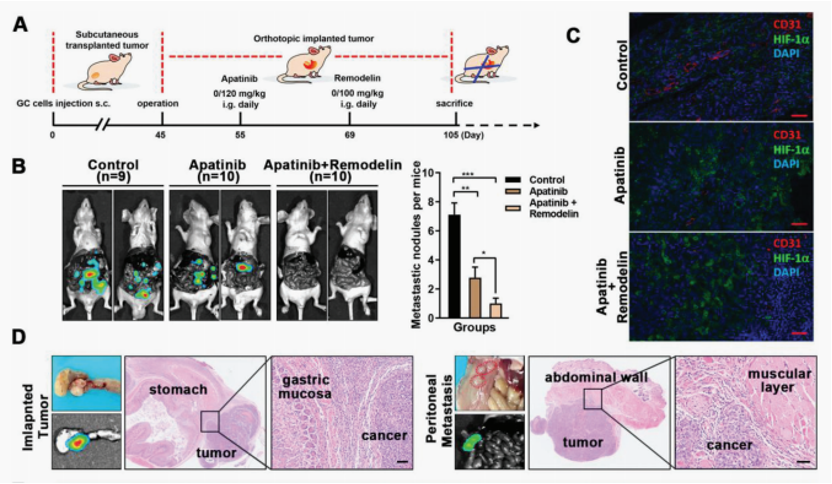 ac4C修饰影响胃癌细胞缺氧耐受性，揭示胃癌治疗新策略医药新闻-ByDrug-一站式医药资源共享中心-医药魔方
