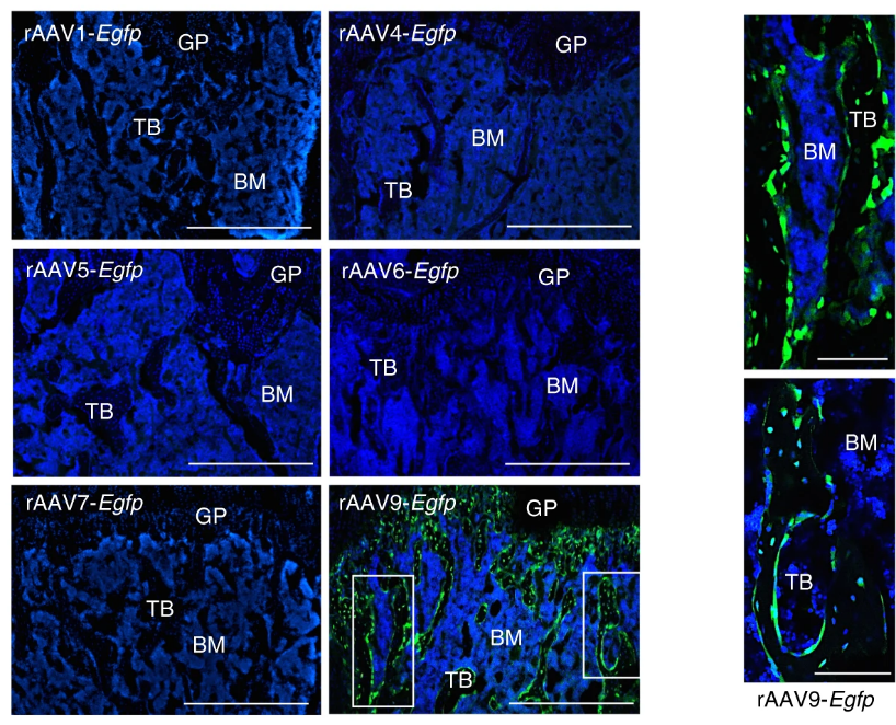 【on-target】AAV感染骨骼 | 血清型·启动子·注射用量 | 一篇就GO了！医药新闻-ByDrug-一站式医药资源共享中心-医药魔方