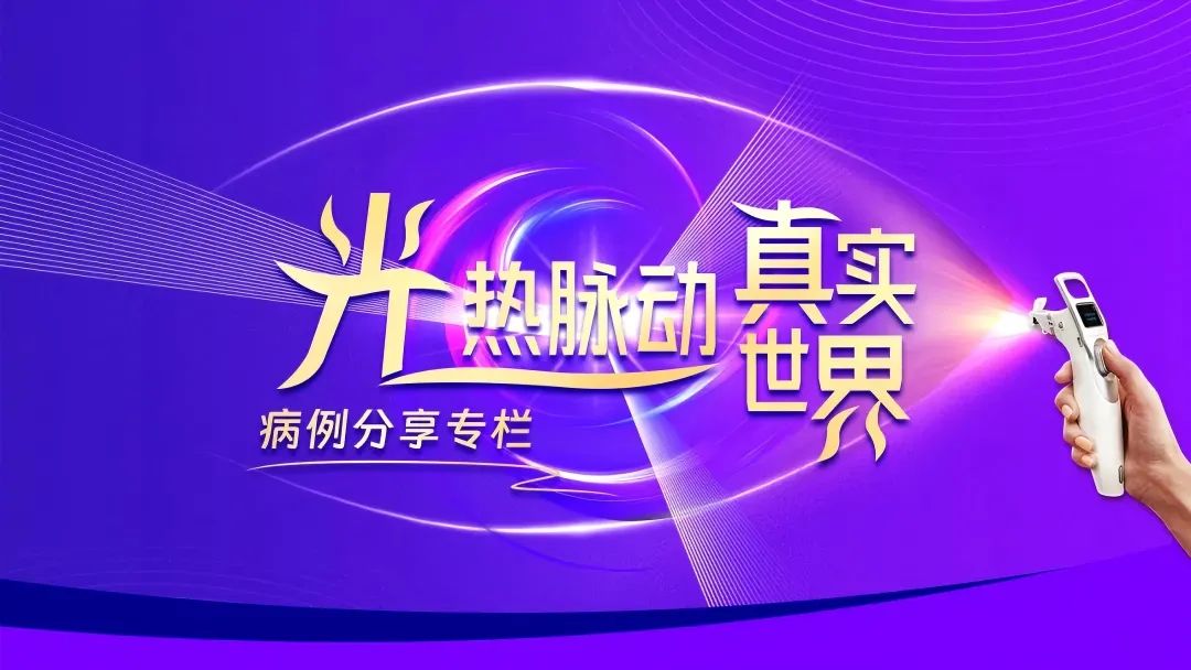 【光热脉动真实世界】屈光白内障术后MGD干眼：光热脉动联合疗法实现精准干预医药新闻-ByDrug-一站式医药资源共享中心-医药魔方