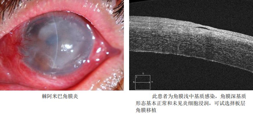 角膜解剖和OCT检查医药新闻-ByDrug-一站式医药资源共享中心-医药魔方