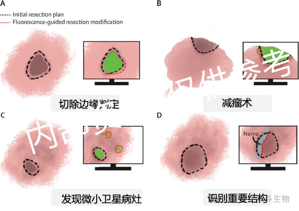 国内首款！新斗生物靶向PSMA肿瘤荧光造影剂IND获受理！医药新闻-ByDrug-一站式医药资源共享中心-医药魔方