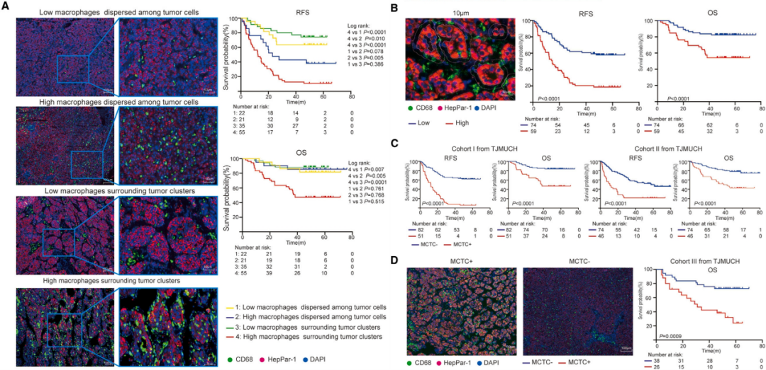 Cell 子刊丨HCC患者预后不良及肿瘤侵袭性的新发现医药新闻-ByDrug-一站式医药资源共享中心-医药魔方