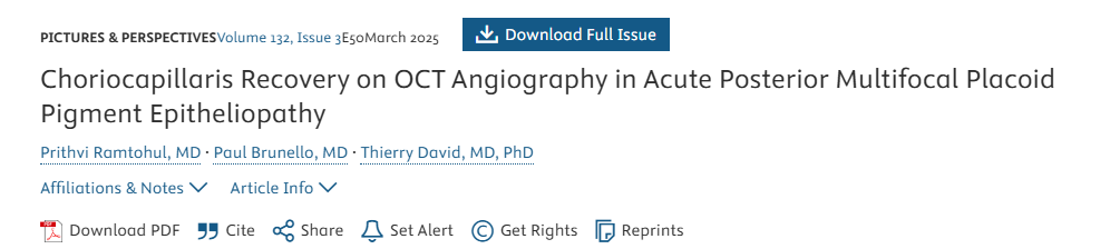 慧眼识图 | 脉络膜毛细血管的复苏之旅：APMPPE患者视网膜下病灶变化的OCTA影像密码医药新闻-ByDrug-一站式医药资源共享中心-医药魔方