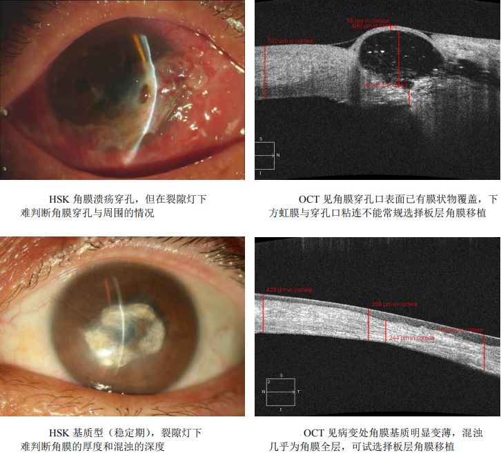 角膜解剖和OCT检查医药新闻-ByDrug-一站式医药资源共享中心-医药魔方