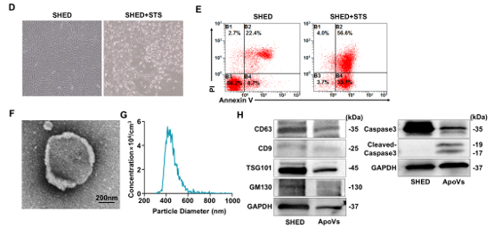Adv Sci：转录组+蛋白质组揭示间充质干细胞来源的凋亡小泡靶向调控CD8+ T细胞稳态缓解超敏反应的作用机制医药新闻-ByDrug-一站式医药资源共享中心-医药魔方