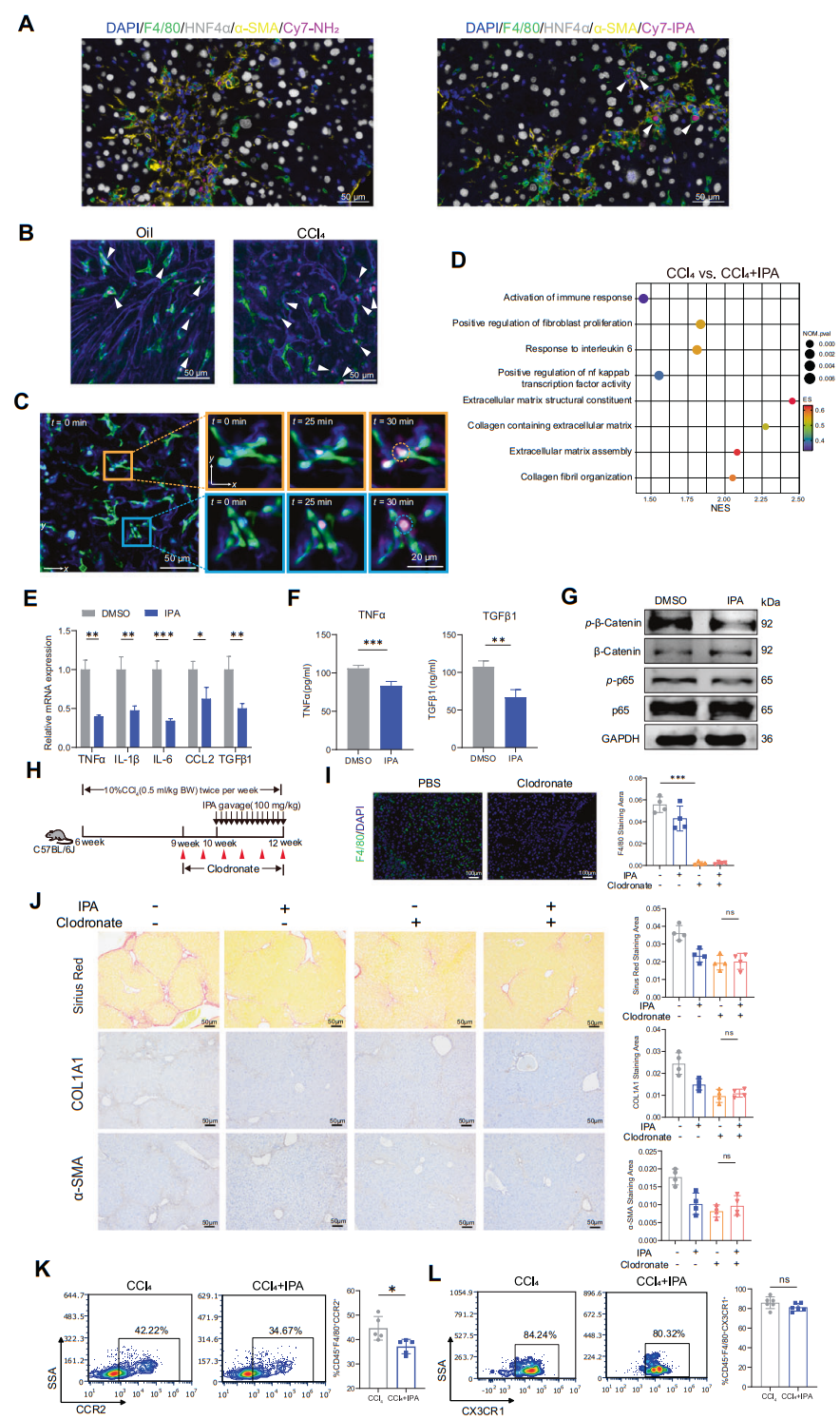 Cell Mol Immunol. | 曾欣/林勇团队揭示肠道代谢物IPA缓解肝纤维化的机制医药新闻-ByDrug-一站式医药资源共享中心-医药魔方