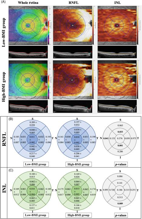 OCT扫描检测：肥胖症对视网膜完整性的早期潜在影响医药新闻-ByDrug-一站式医药资源共享中心-医药魔方