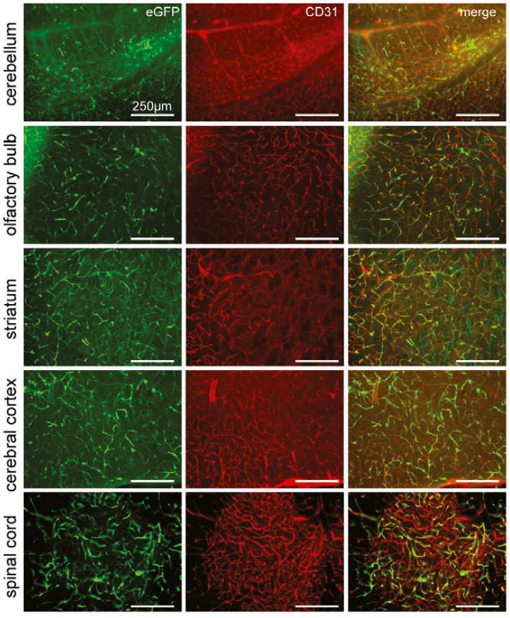一针注射，静脉到脑 | 跨血脑屏障AAV载体总结医药新闻-ByDrug-一站式医药资源共享中心-医药魔方