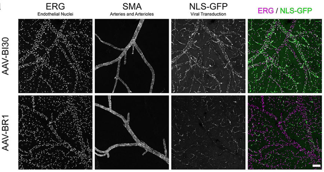 一针注射，静脉到脑 | 跨血脑屏障AAV载体总结医药新闻-ByDrug-一站式医药资源共享中心-医药魔方
