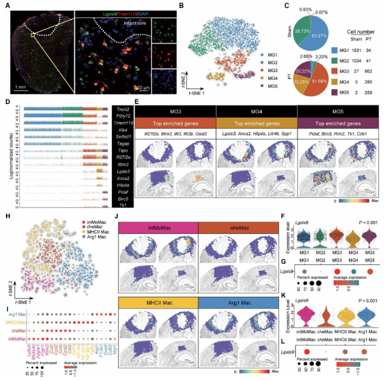 Sci Transl Med | 东南大学姚红红教授团队揭示LGALS9-CD44信号通路在卒中后脑修复中的重要作用医药新闻-ByDrug-一 ...
