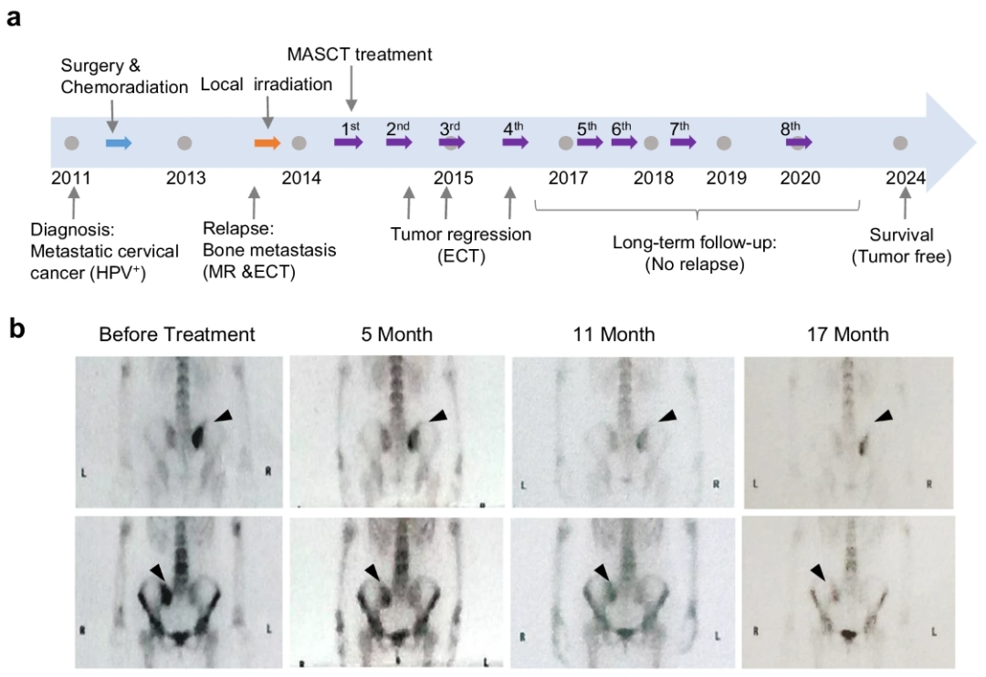 恒瑞源正靶向HPV18阳性实体瘤TCR-T研究成果发表医药新闻-ByDrug-一站式医药资源共享中心-医药魔方