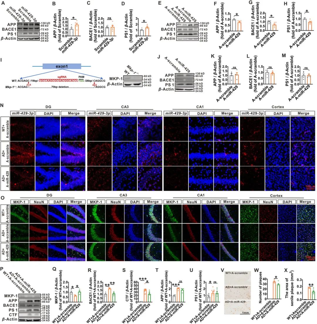 APSB（IF14+）丨抑制miR-429-3p可有效改善AD模型小鼠的认知和突触功能医药新闻-ByDrug-一站式医药资源共享中心-医药魔方