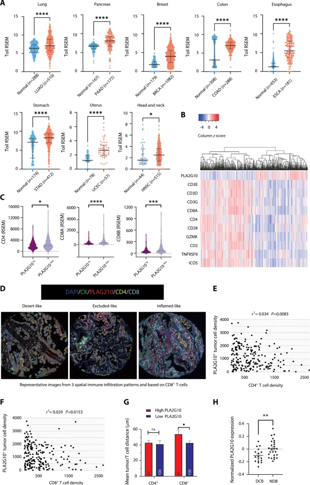 陈列平最新成果：癌症免疫治疗新靶点——PLA2G10医药新闻-ByDrug-一站式医药资源共享中心-医药魔方