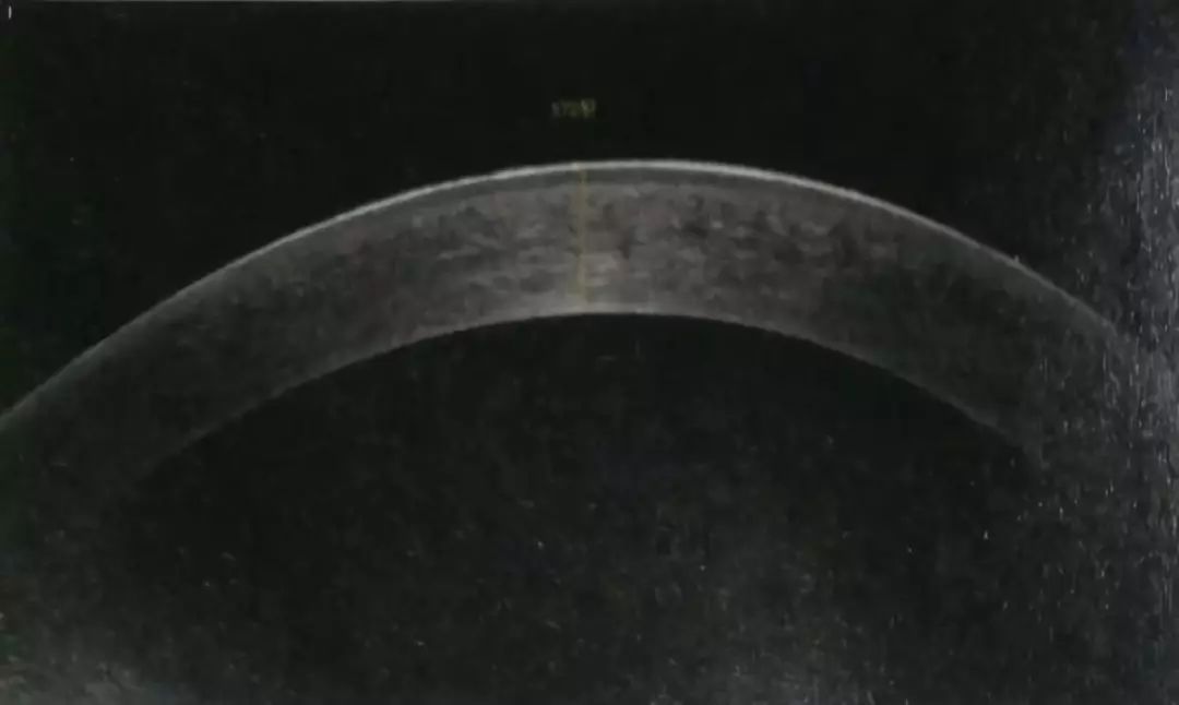 角膜解剖和OCT检查医药新闻-ByDrug-一站式医药资源共享中心-医药魔方