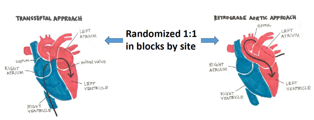 张玉顺教授：采用Valvosoft®治疗可改善重度主动脉瓣狭窄患者的生活质量丨ACC热评医药新闻-ByDrug-一站式医药资源共享中心-医药魔方