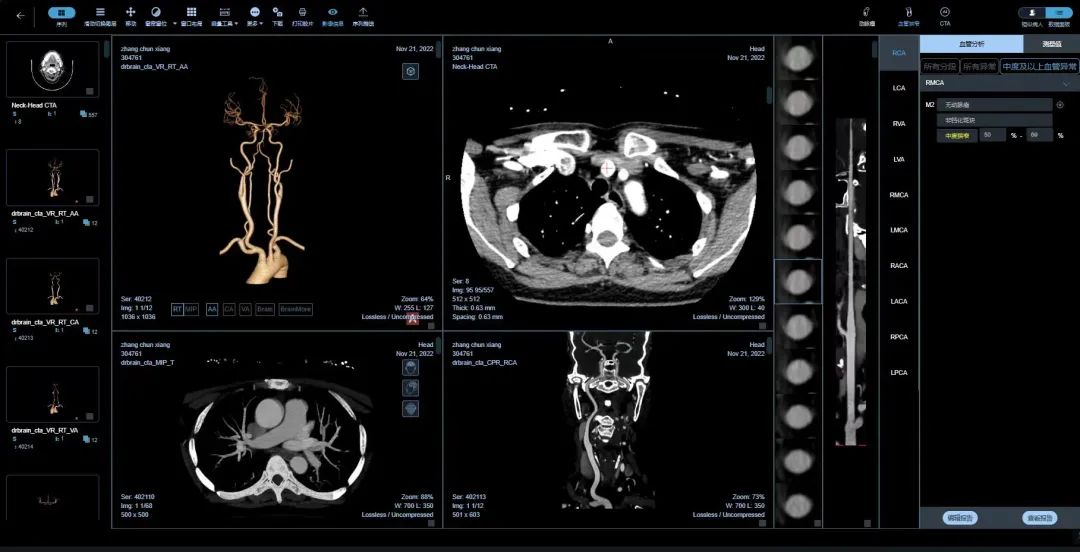 医未AI卒中获批NMPA三类证｜道彤Family医药新闻-ByDrug-一站式医药资源共享中心-医药魔方