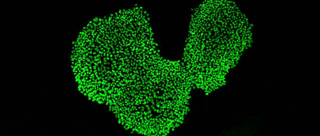 文献解读 | iPSC治疗潜力，看这一篇就够了医药新闻-ByDrug-一站式医药资源共享中心-医药魔方