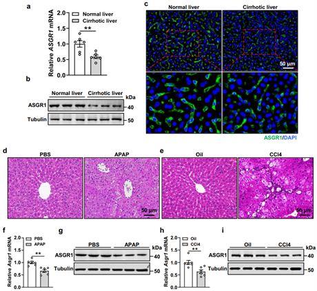 Nat Com丨ASGR1助力减缓肝损伤医药新闻-ByDrug-一站式医药资源共享中心-医药魔方