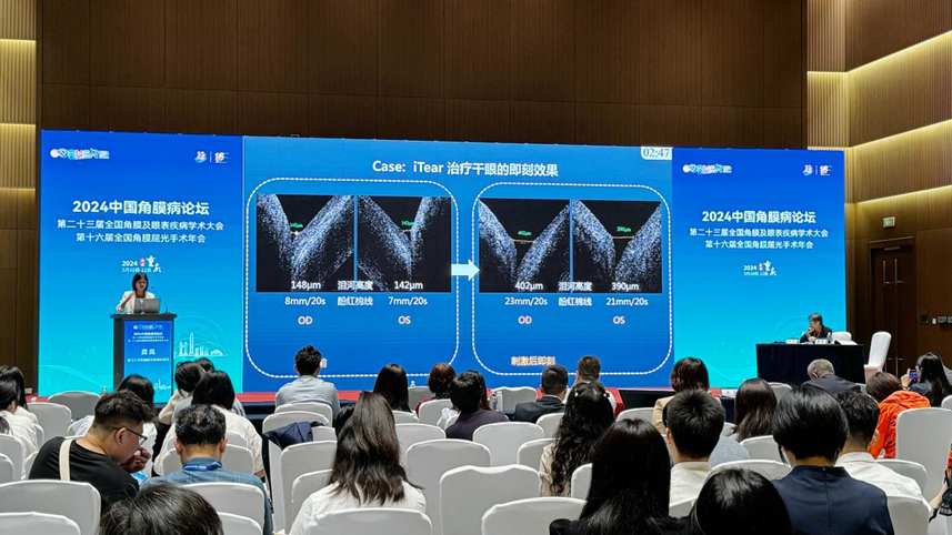 鼻外神经刺激天然泪液疗法｜iTEAR 睦沁®即将上市医药新闻-ByDrug-一站式医药资源共享中心-医药魔方