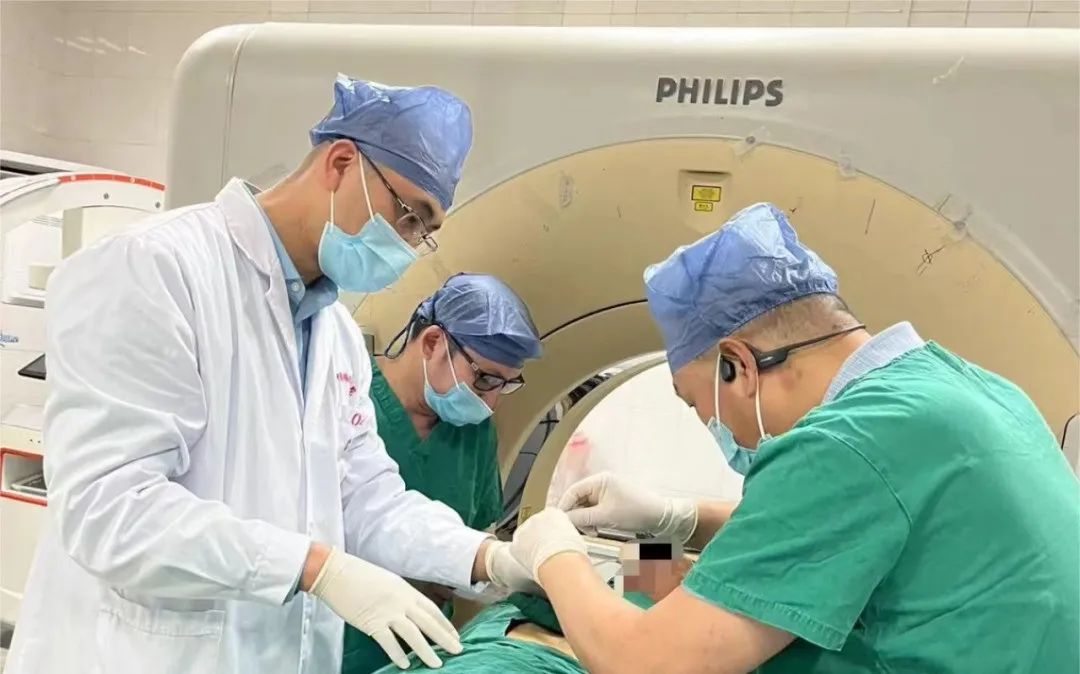 【肿瘤与血管介入科·医疗案例】新技术：CT引导下经皮胃造瘘术医药新闻-ByDrug-一站式医药资源共享中心-医药魔方