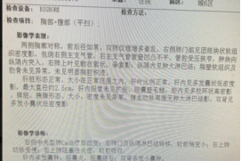 “参”临其境 “一”路相伴——典型病例【肺癌108】医药新闻-ByDrug-一站式医药资源共享中心-医药魔方