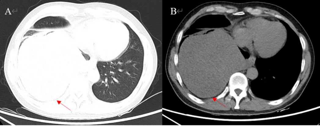 【特色技术】探测肿瘤的利器—肿瘤诊断界的“福尔摩斯” ——全身PET/CT医药新闻-ByDrug-一站式医药资源共享中心-医药魔方