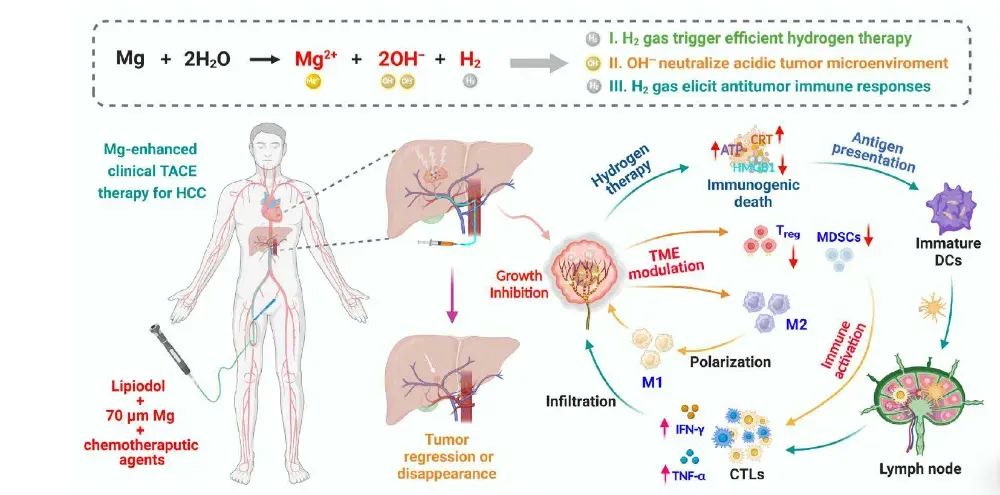 Sci. Adv.丨金属镁微球增效肝癌介入栓塞治疗：从概念验证到早期临床研究医药新闻-ByDrug-一站式医药资源共享中心-医药魔方