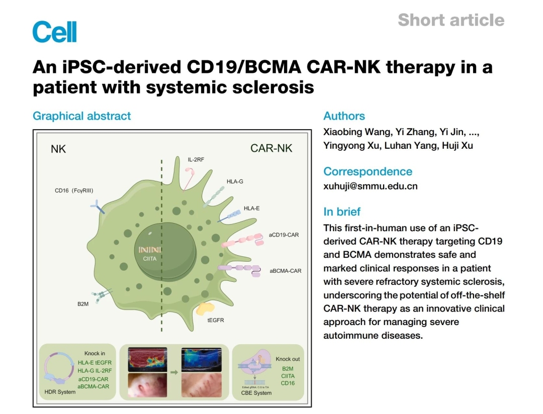 从大脑到心脏，红杉医疗成员企业收获多项成果｜Healthcare View医药新闻-ByDrug-一站式医药资源共享中心-医药魔方