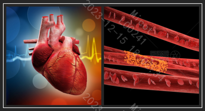麦科奥特1.1类新药MT1002新增肾透析抗凝适应症顺利通过FDA审评获批II期临床试验许可医药新闻-ByDrug-一站式医药资源共享中心-医药魔方