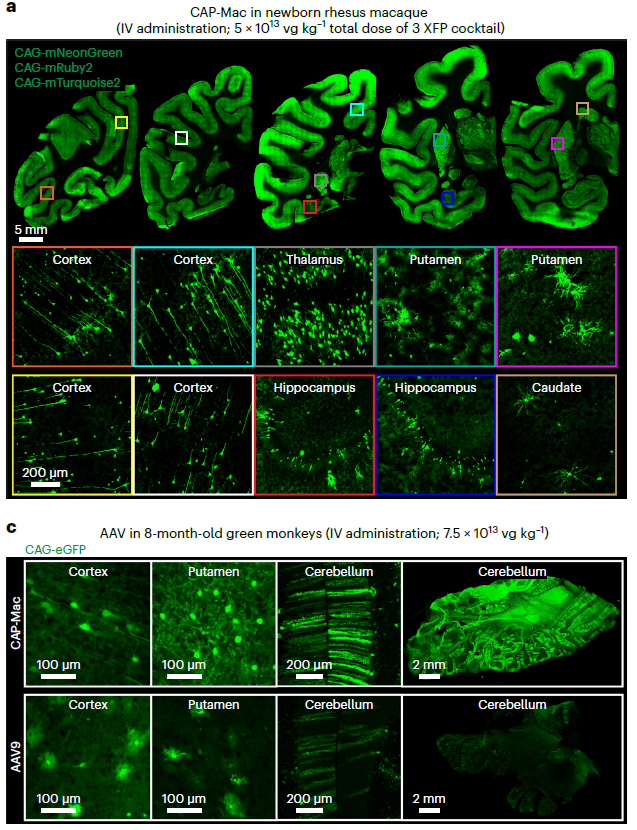 一针注射，静脉到脑 | 跨血脑屏障AAV载体总结医药新闻-ByDrug-一站式医药资源共享中心-医药魔方