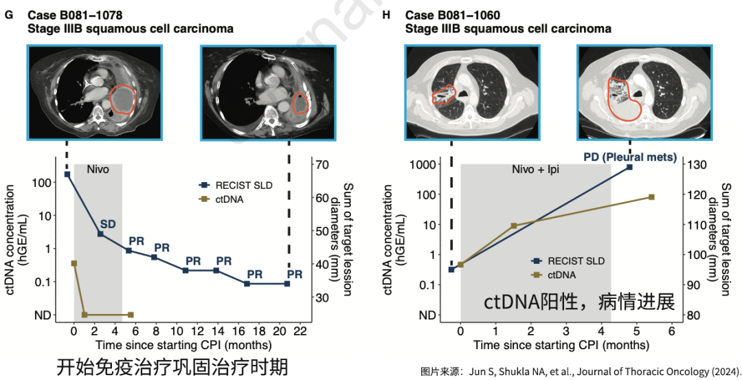 III期肺癌放化疗和免疫治疗前后ctDNA分组，活过2年的比例差2倍！医药新闻-ByDrug-一站式医药资源共享中心-医药魔方