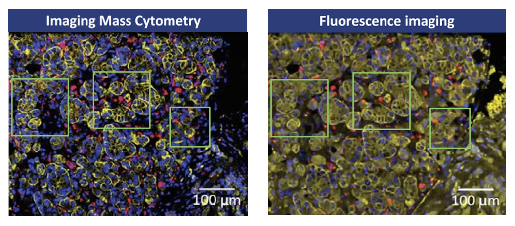 新品发布 | IMC组织质谱流式成像解决方案助力单细胞空间生物学深度探索医药新闻-ByDrug-一站式医药资源共享中心-医药魔方