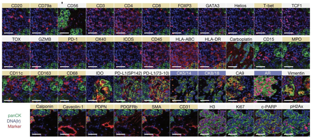 新品发布 | IMC组织质谱流式成像解决方案助力单细胞空间生物学深度探索医药新闻-ByDrug-一站式医药资源共享中心-医药魔方