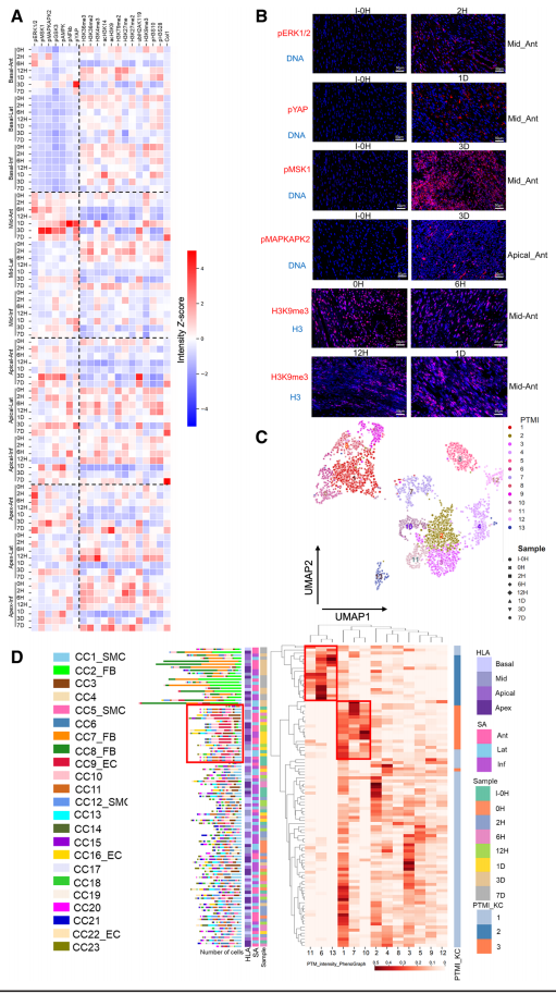 Circulation Research | IMC 助力心脏缺血再灌注损伤的空间蛋白研究医药新闻-ByDrug-一站式医药资源共享中心-医药魔方