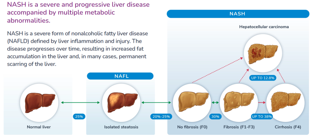 1.5亿美元公开募股，89bio拟明年启动NASH药物3期临床试验医药新闻-ByDrug-一站式医药资源共享中心-医药魔方
