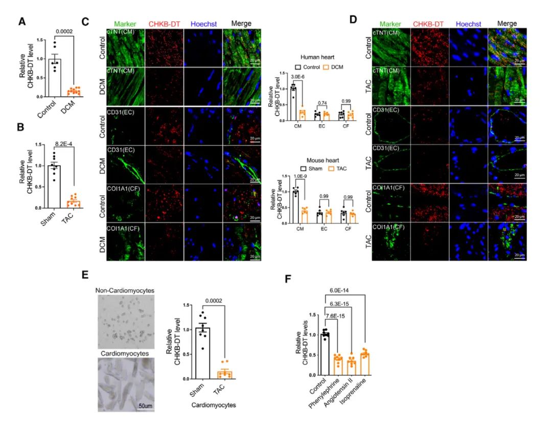 Circ Res（IF20+）丨LncRNA CHKB-DT下调通过ALDH2增强扩张型心肌病医药新闻-ByDrug-一站式医药资源共享中心-医药魔方