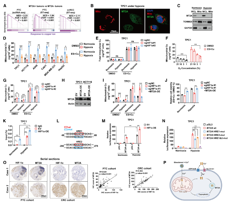 Cancer Cell｜姚兵/向俊研究团队揭示靶向HIF-1α-MT2A轴可克服肿瘤细胞的铜死亡抗性医药新闻-ByDrug-一站式医药资源共享中心-医药魔方