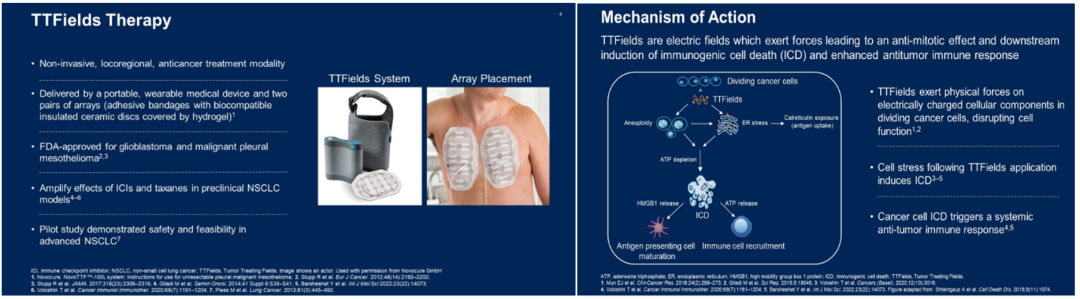 【3578】张力教授专访：解读LUNAR研究，TTFields开启肺癌治疗新模式医药新闻-ByDrug-一站式医药资源共享中心-医药魔方